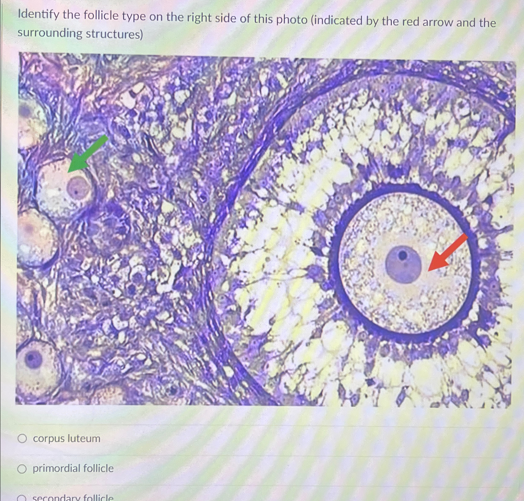 Solved Identify the follicle type on the right side of this | Chegg.com