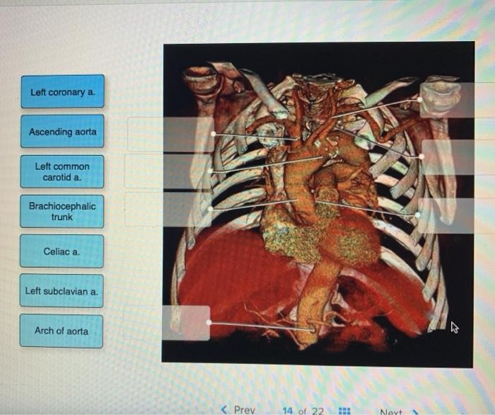 Left coronary a. Ascending aorta Left common carotid | Chegg.com