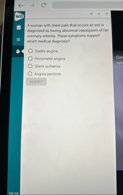 Solved A woman with chest pain that occurs at rest is | Chegg.com