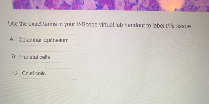 19 20 Wis Use the exact terms in your V-Scope | Chegg.com