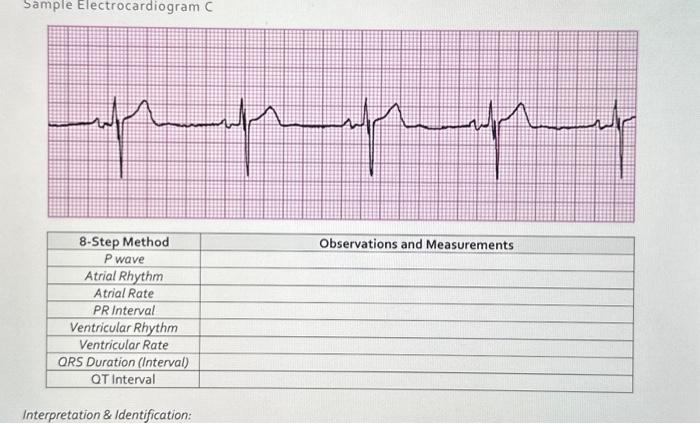 Solved Sample Electrocardiogram C Interpretation \& | Chegg.com