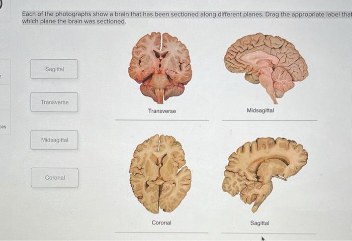 Solved Each of the photographs show a brain that has been | Chegg.com