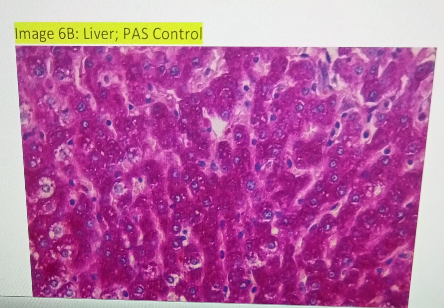 Solved Image 6B: Liver; PAS Control Image 6B: Liver; PAS | Chegg.com