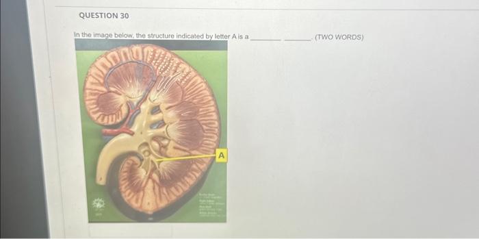 Solved In the image below. the structure indiratar thu | Chegg.com