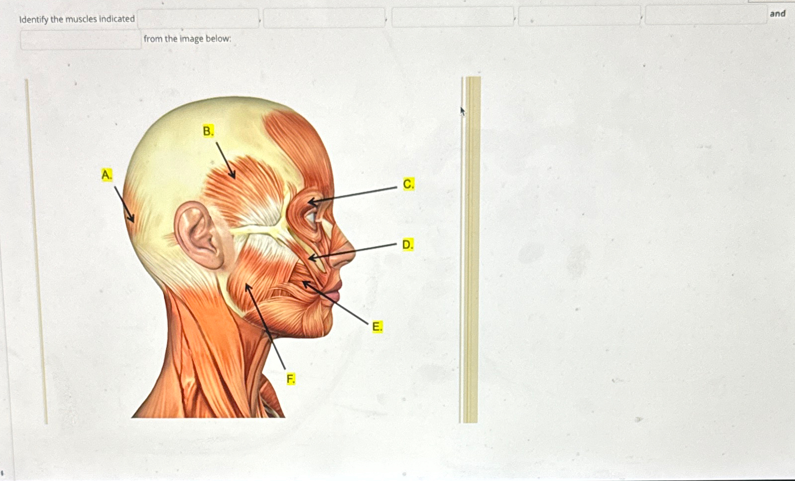 Solved Identify the muscles indicatedandfrom the image | Chegg.com