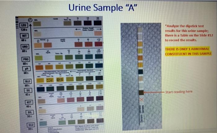 Urine Sample “A” LEU 1205 *Analyze the dipstick test | Chegg.com