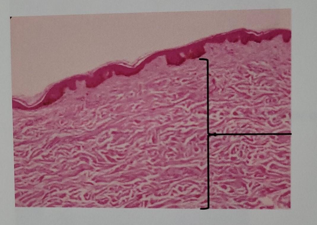 Solved name the layer/region at tip of pointer is composed | Chegg.com