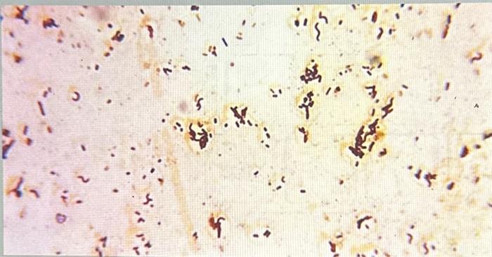 Solved label a cocci, bacilli, and spirilla | Chegg.com