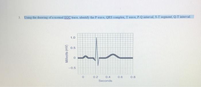 Solved 3 Using the drawing of a normal EGC trace, identify | Chegg.com