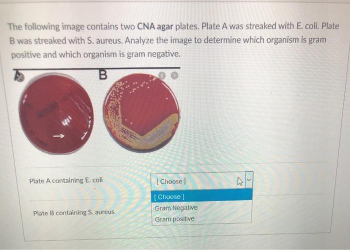 Solved The following image contains two CNA agar plates. | Chegg.com