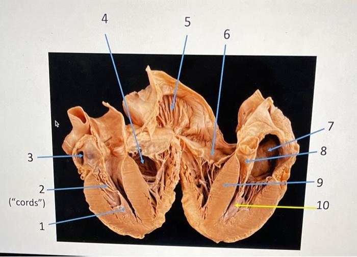 Solved label heart dissection | Chegg.com