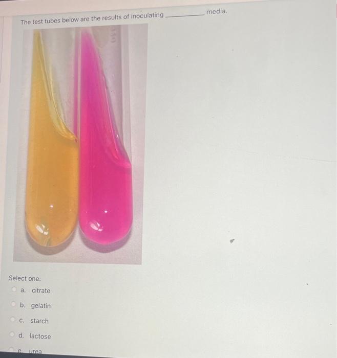 Solved lect one: a. citrate b. gelatin c. starch d. lactose | Chegg.com