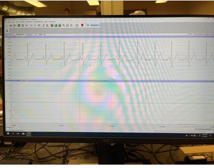 include image of the EKG with the waves labeled, | Chegg.com