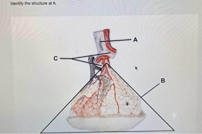 Solved Identify the structure at A. | Chegg.com