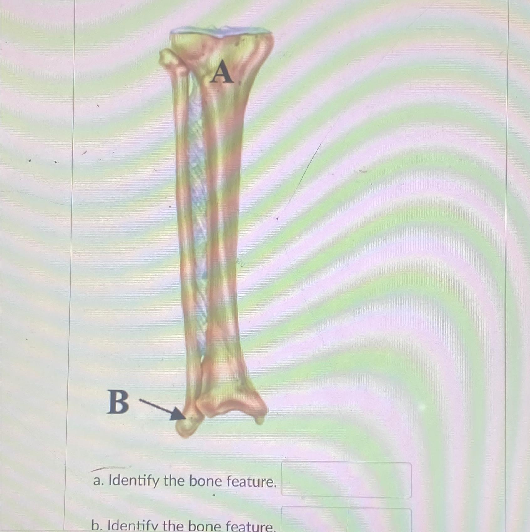 Solved a. ﻿Identify the bone feature.b. ﻿Identify the bone | Chegg.com