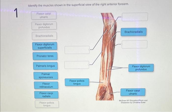 Solved identify the muscles shown in the superficial view | Chegg.com