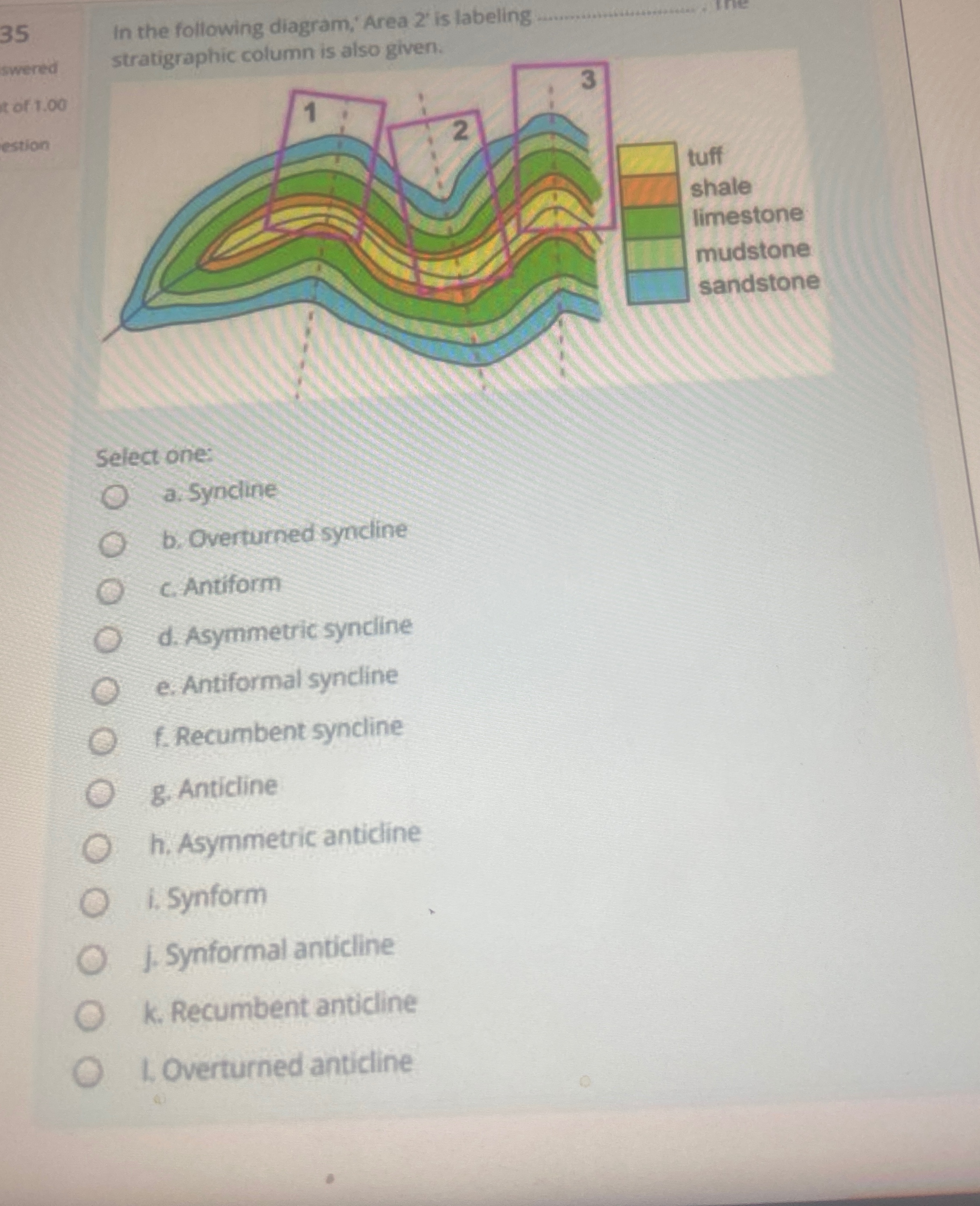 Solved In the following diagram; 'Area Z' ﻿is labeling | Chegg.com