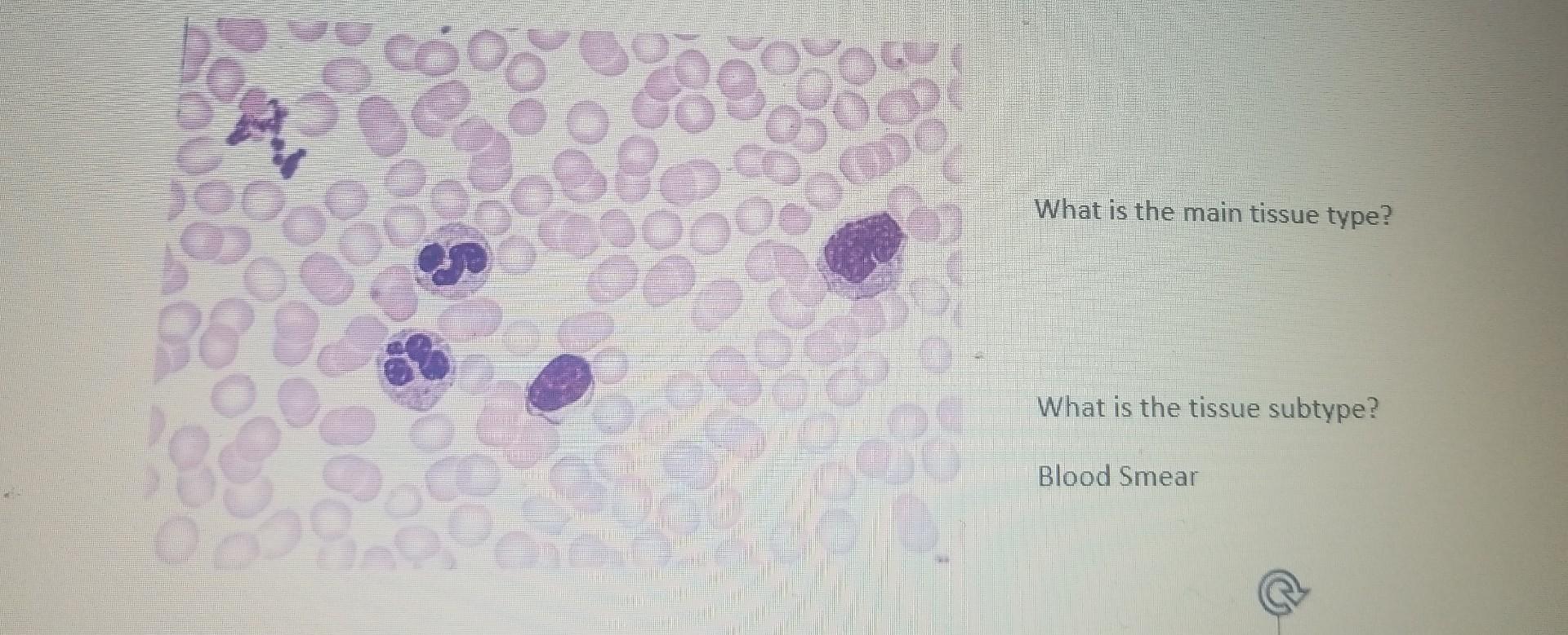 Solved What is the main tissue type? What is the main | Chegg.com