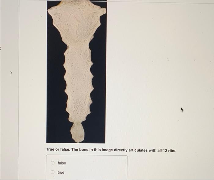 Solved True or false. The bone in this image directly | Chegg.com