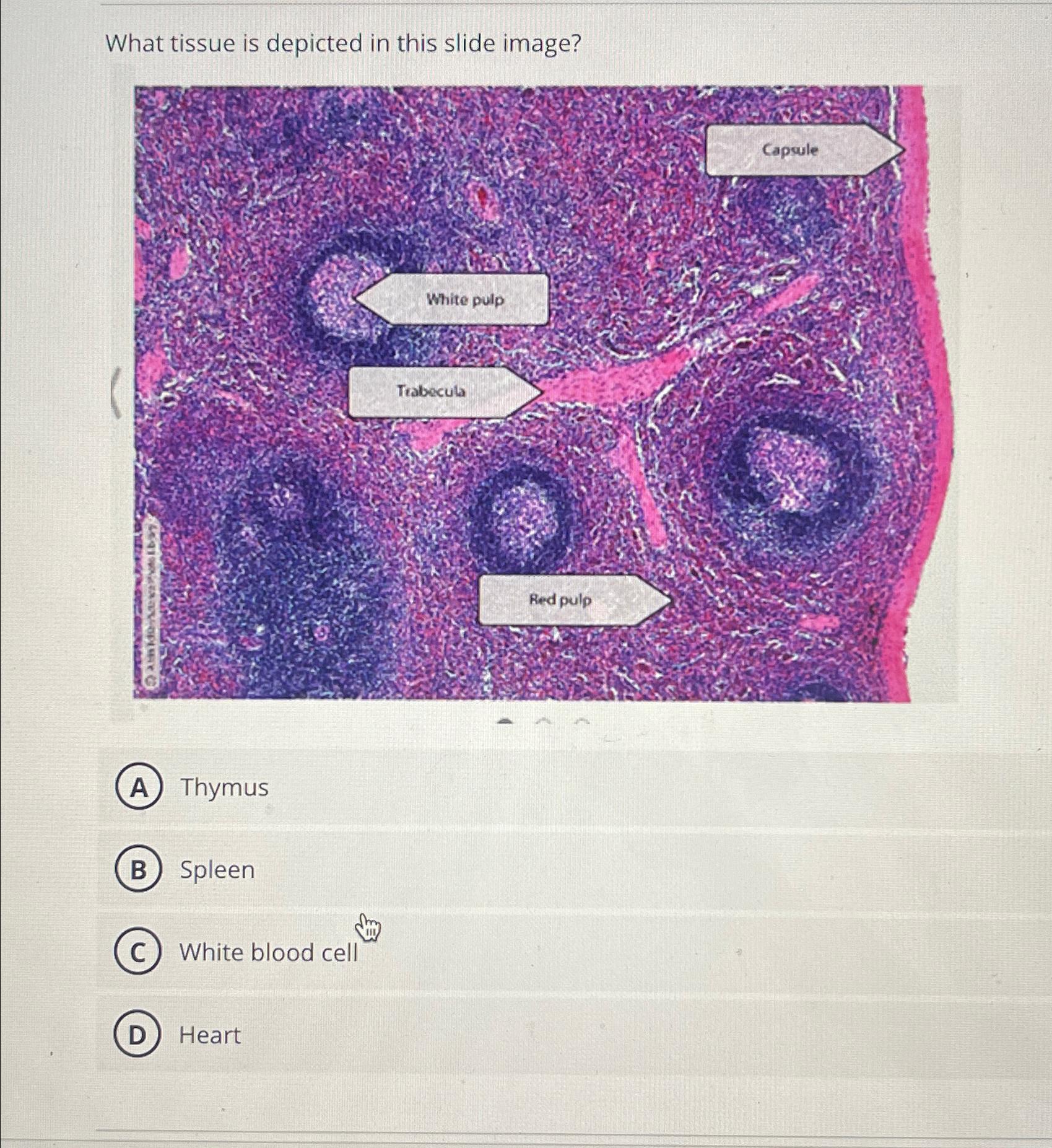 Solved What tissue is depicted in this slide | Chegg.com