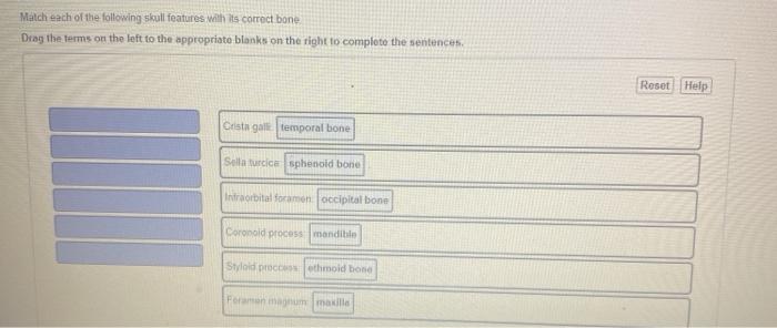 Solved Match each of the following skull features with its | Chegg.com
