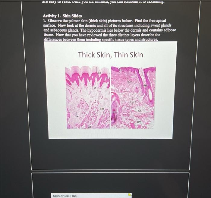 Solved Activity 1. Skin Slides 1. Observe the palmar skin | Chegg.com
