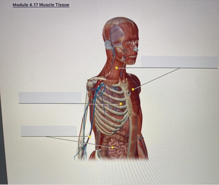 Solved Module 4.17 Muscle Tissue | Chegg.com