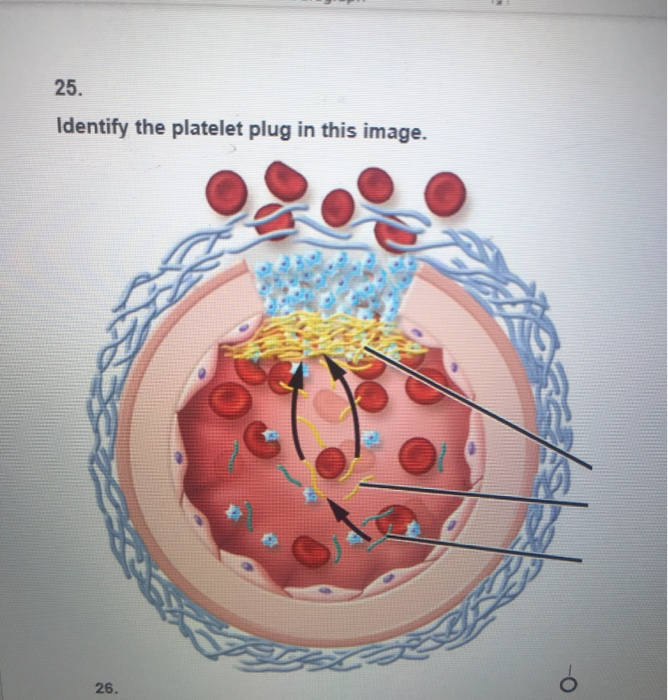 Solved 25. Identify the platelet plug in this image. 26. | Chegg.com