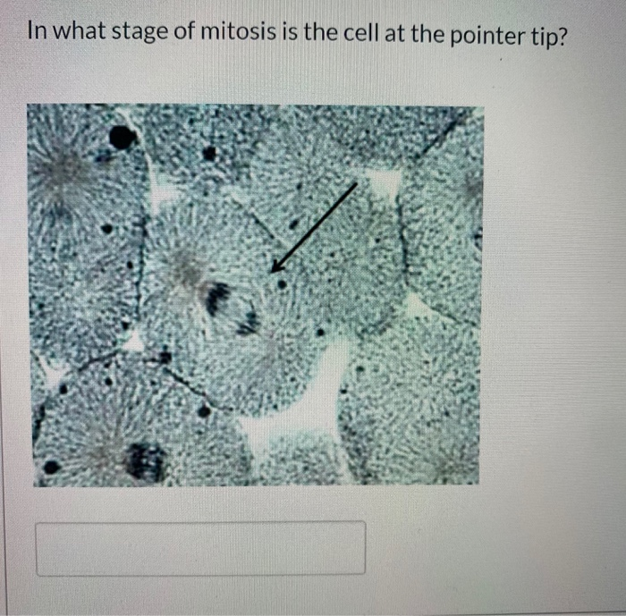 Solved In what stage of mitosis is the cell at the pointer | Chegg.com