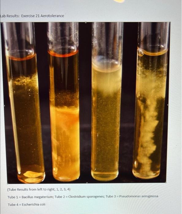 Solved Aerotolerance Your Results and Observations Draw or | Chegg.com
