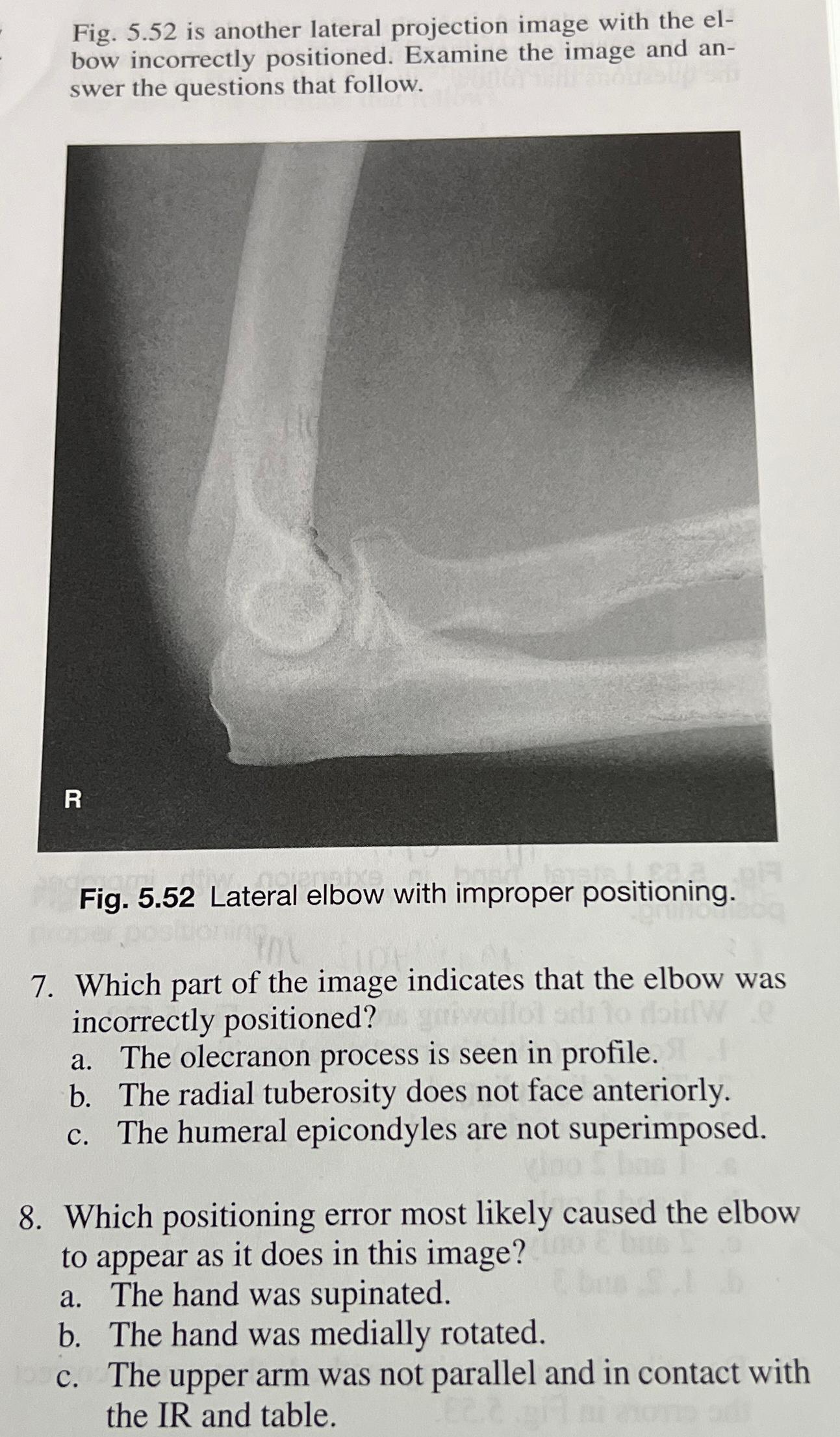 Fig. 5.52 ﻿is another lateral projection image with | Chegg.com