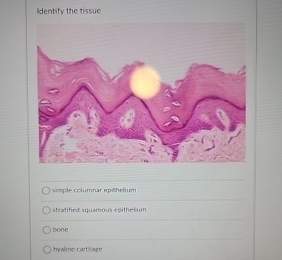 Solved Identify the tissuesimple columnar | Chegg.com