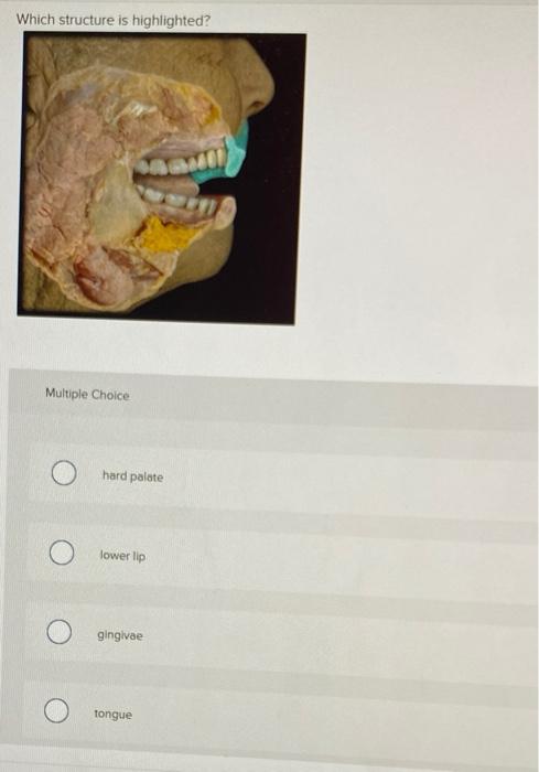 Solved Which structure is highlighted? Multiple Choice O | Chegg.com
