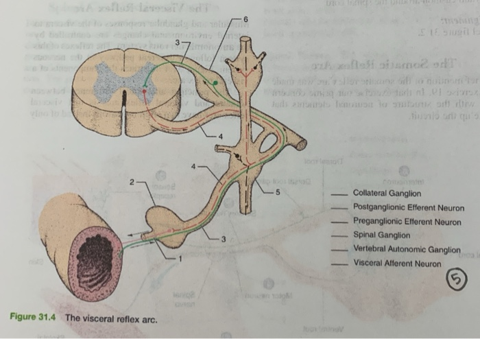 Solved D inli Collateral Ganglion Postganglionic Efferent | Chegg.com