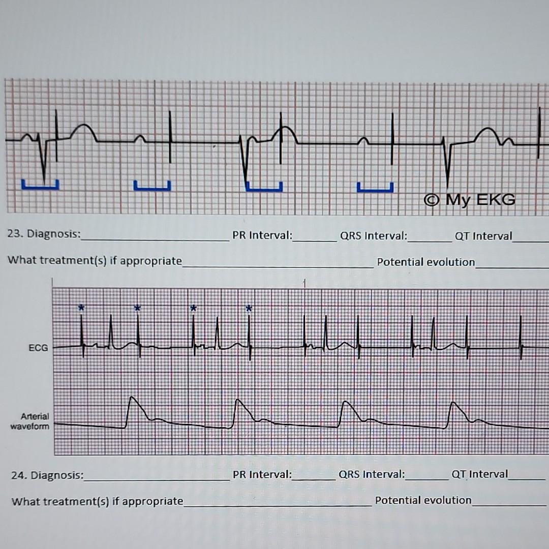 you © My EKG 23. Diagnosis: PR Interval: QRS | Chegg.com
