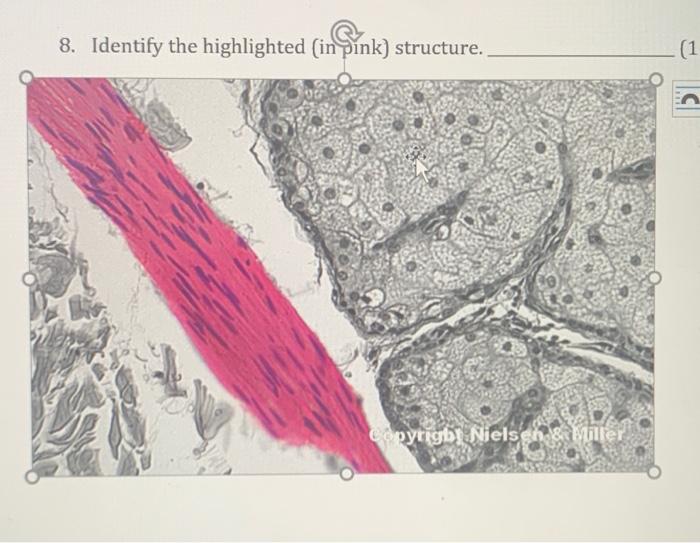 Solved 8. Identify the highlighted in pink) structure. (1 | Chegg.com