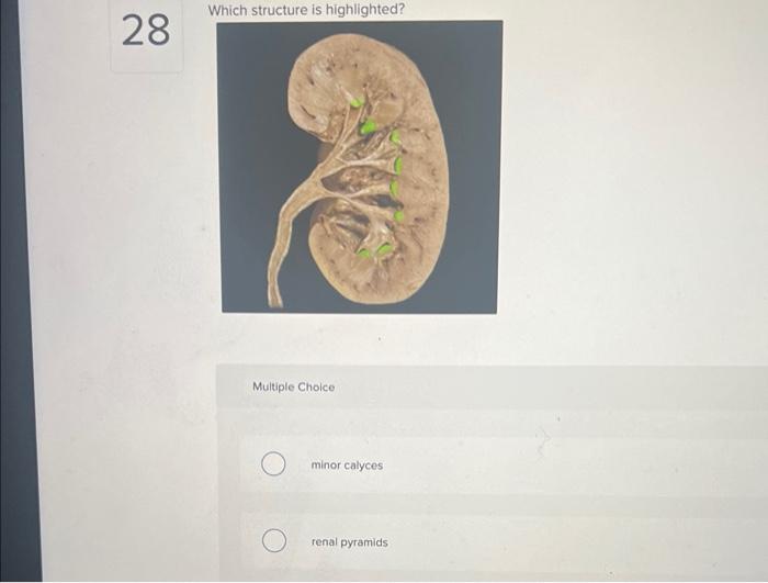 Solved Which structure is highlighted? Multiple Choice | Chegg.com