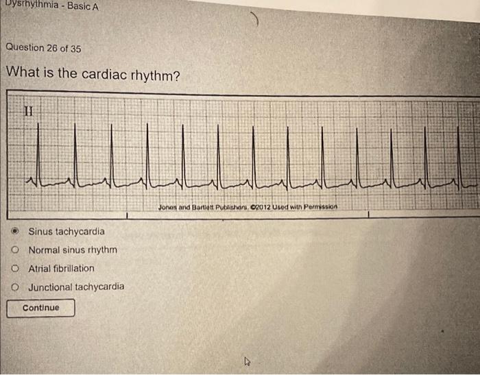 Solved Dysrhythmia - Basic A Question 26 of 35 What is the | Chegg.com