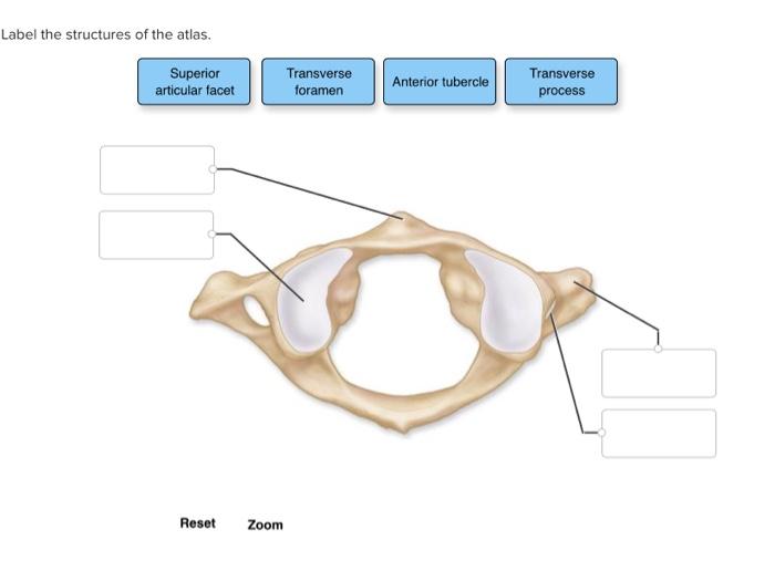 Solved Identify the structures seen in the superior view of | Chegg.com