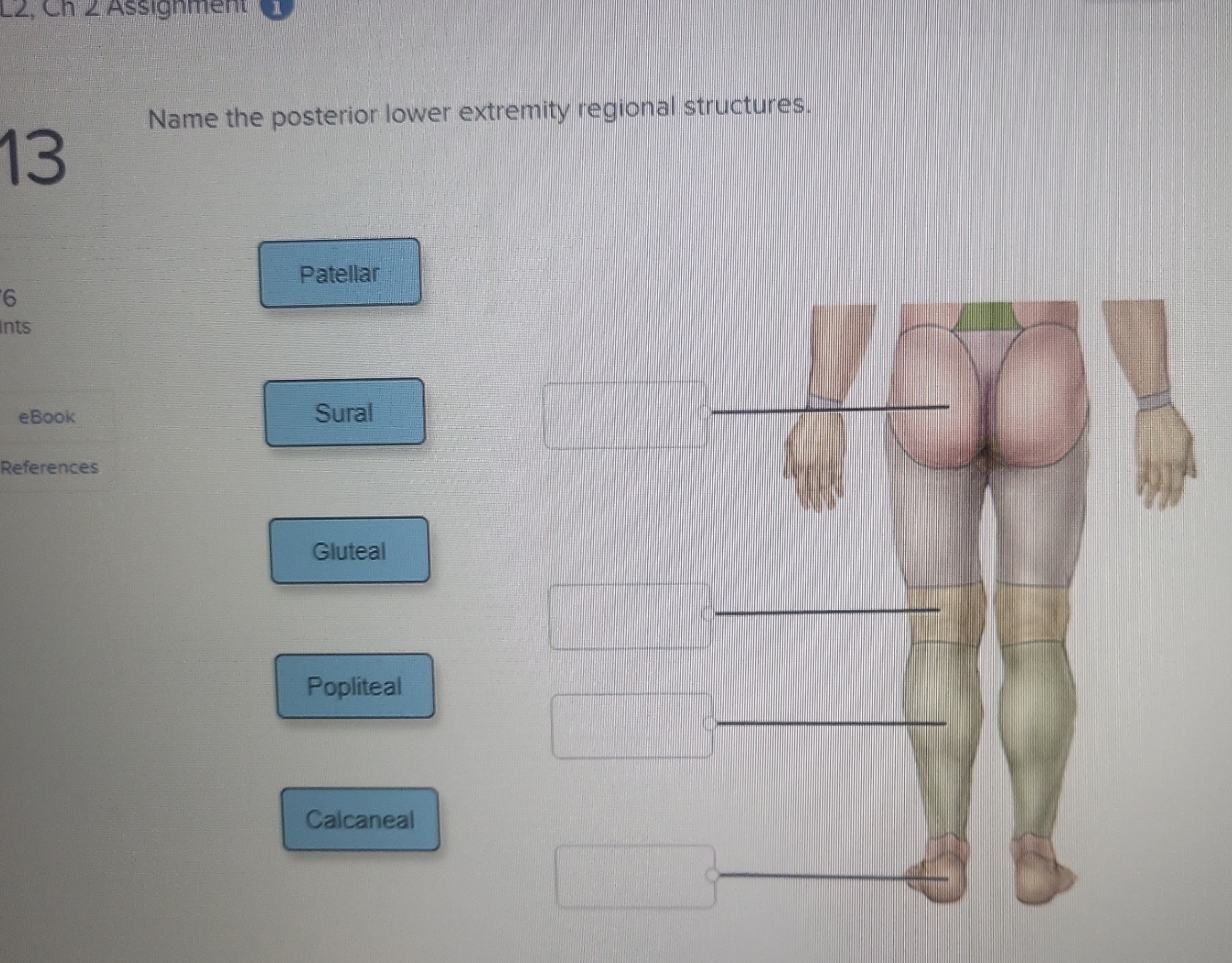 Solved Name the posterior lower extremity regional | Chegg.com