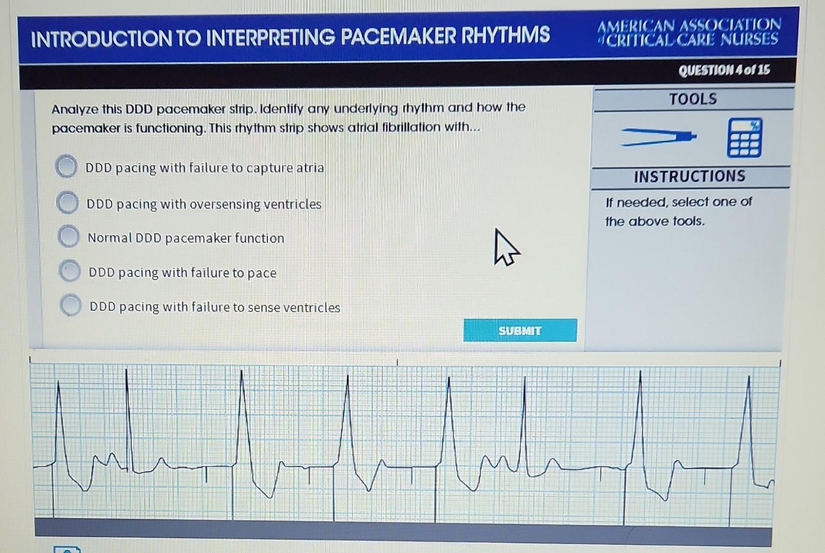 Pacemaker Rhythm Strips