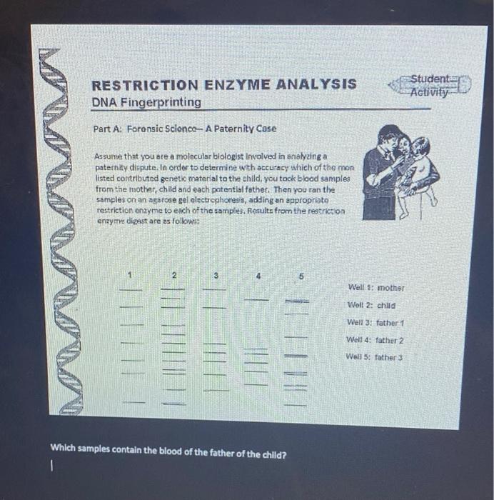 Solved RESTRICTION ENZYME ANALYSIS DNA Fingerprinting | Chegg.com