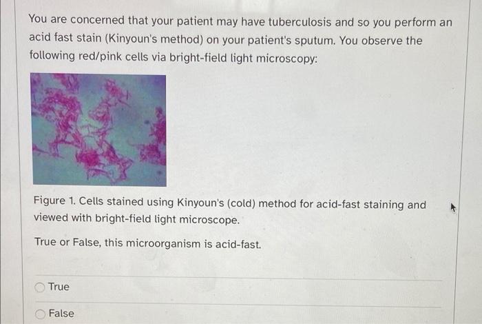 Solved You are concerned that your patient may have | Chegg.com