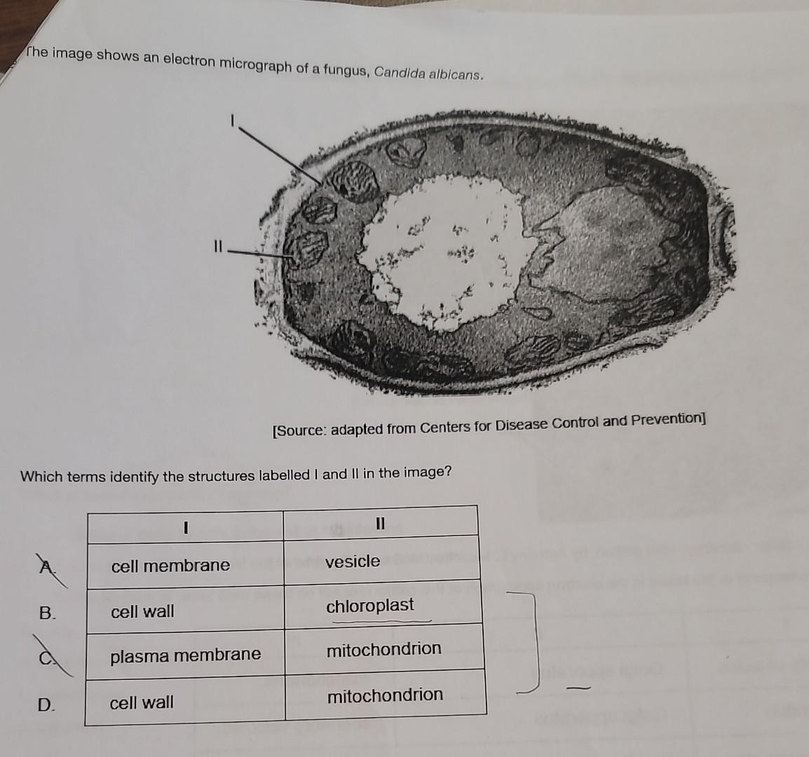 Solved The image shows an electron micrograph of a fungus, | Chegg.com