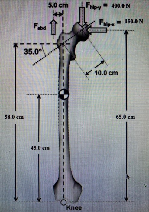 Solved a 7.00kg femur segment is shown below in static | Chegg.com