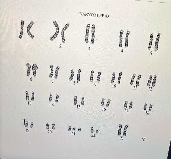 Solved 6. Examine the following karyotypes and answer the | Chegg.com