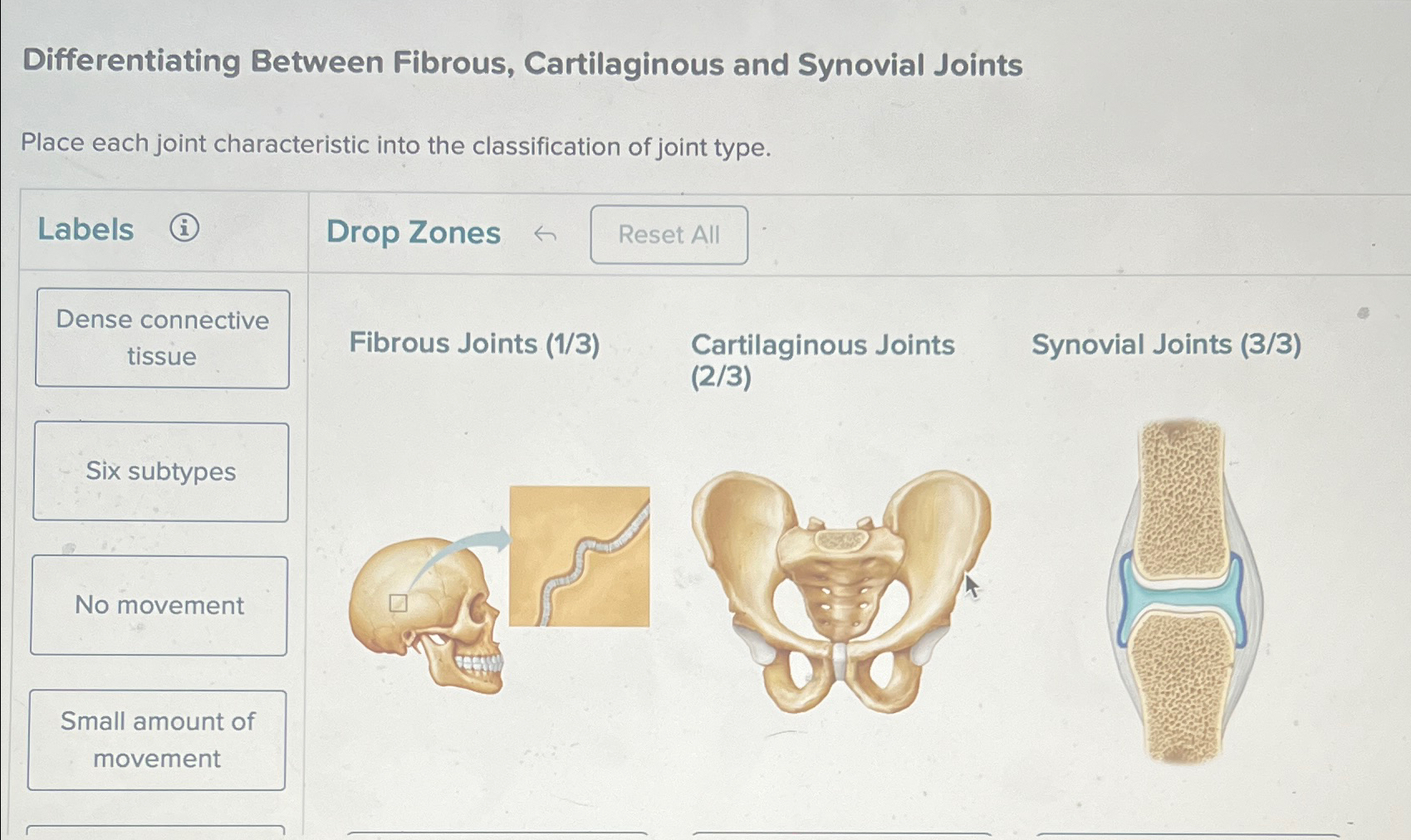 Solved Differentiating Between Fibrous, Cartilaginous and | Chegg.com