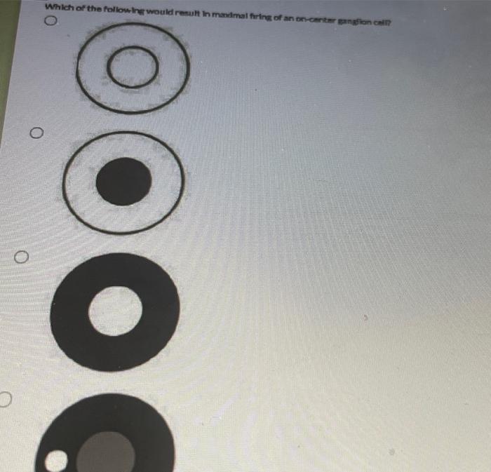 Solved A B C D A good example of a non-declarative memory | Chegg.com