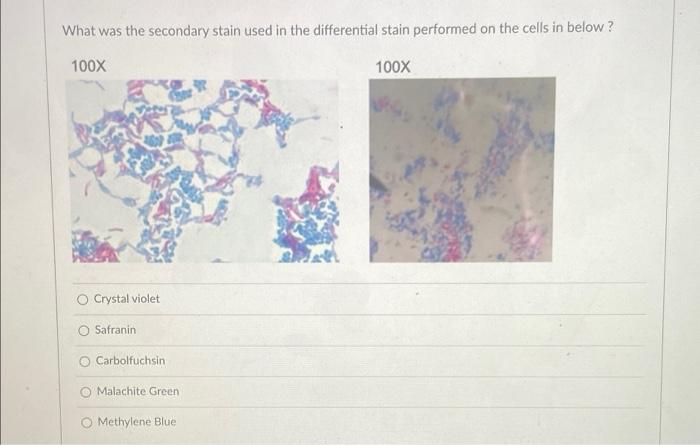 Solved What was the secondary stain used in the differential | Chegg.com
