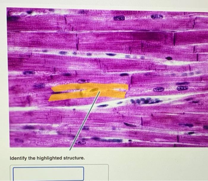 Solved Identify the highlighted structure. | Chegg.com